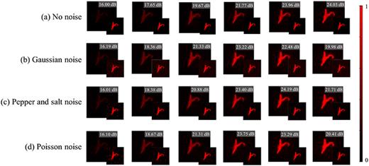 Deep learning-based super-resolution acoustic holography for phased ...