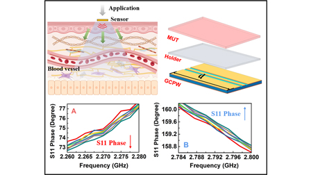 Abnormal trend for noninvasive BGL sensors using phase shift technology ...