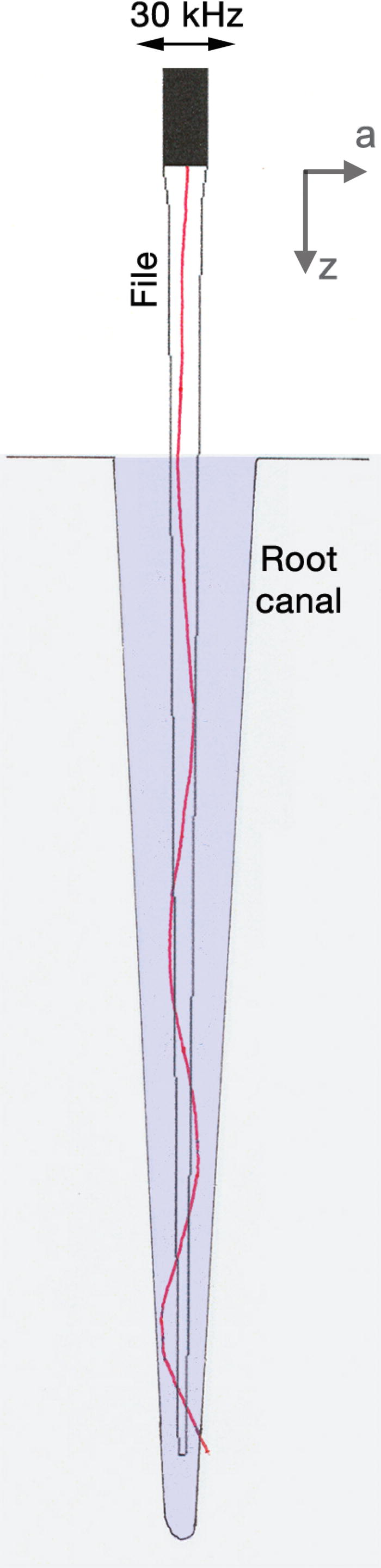 Acoustic streaming induced by an ultrasonically oscillating endodontic ...