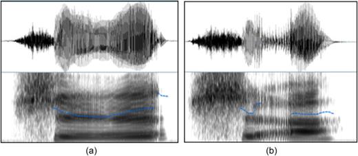 Covariation between voice quality and pitch: Revisiting the case of ...