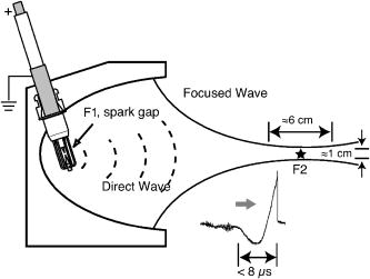 A suppressor to prevent direct wave-induced cavitation in shock wave ...