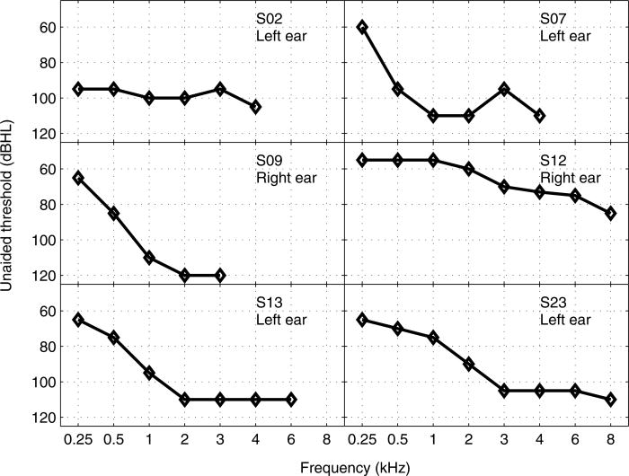 Enhancement of interaural level differences improves sound localization ...