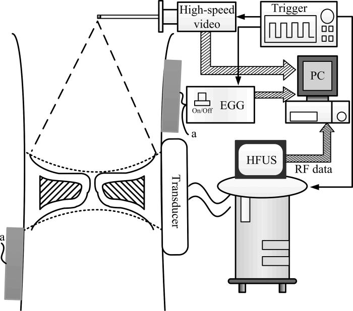 Measuring body layer vibration of vocal folds by high-frame-rate ...