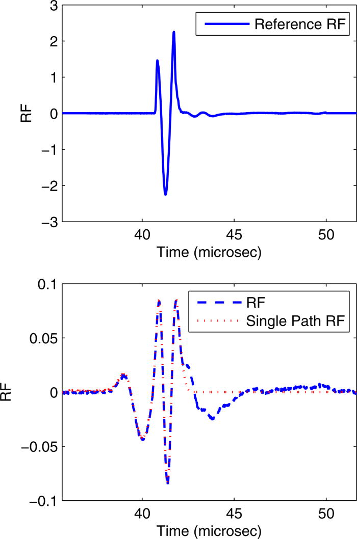 Fast and slow wave detection in bovine cancellous bone in vitro using ...