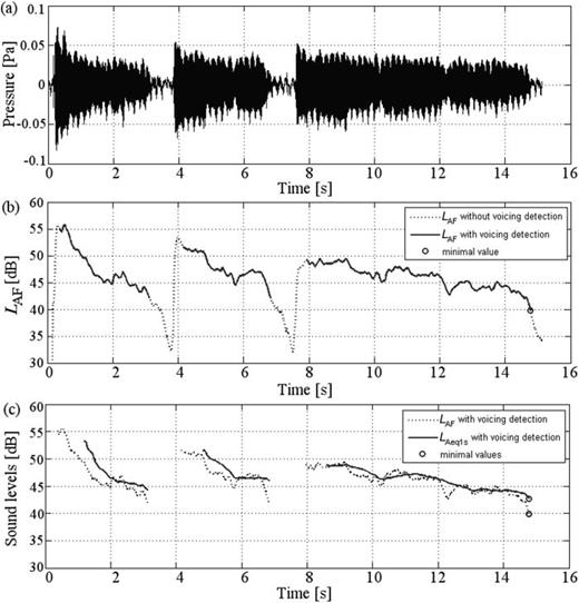 The softest sound levels of the human voice in normal subjects | The ...