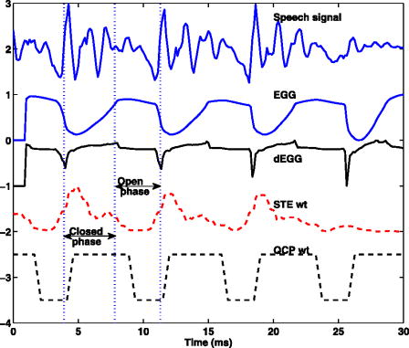 Quasi-closed phase forward-backward linear prediction analysis of ...