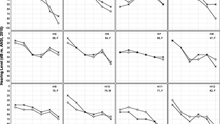 A deep learning based segregation algorithm to increase speech intelligibility for hearing ...