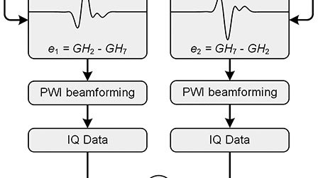 Contrast-enhanced ultrasound imaging using pulse inversion spectral ...