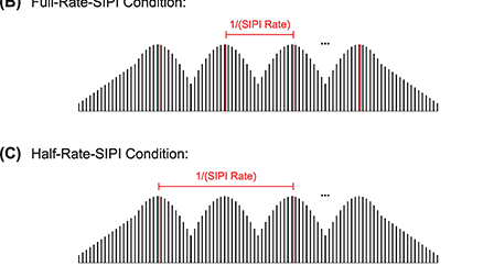 Temporal-pitch sensitivity in electric hearing with amplitude ...