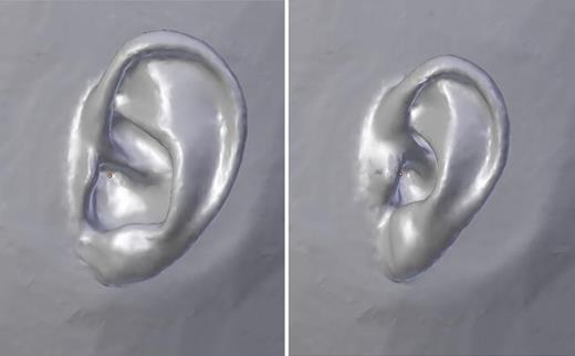 Sensitivity analysis of pinna morphology on head-related transfer ...