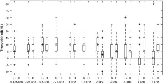 Reference equivalent threshold sound pressure levels for the Wireless ...