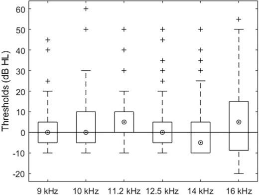 Reference equivalent threshold sound pressure levels for the Wireless ...