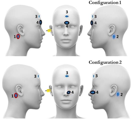 Envelope following responses for hearing diagnosis: Robustness and ...