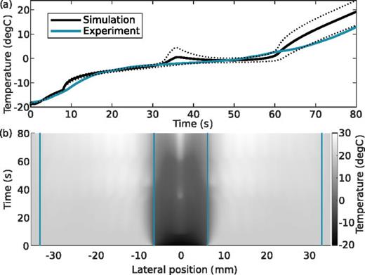 Experiments and simulations demonstrating the rapid ultrasonic ...