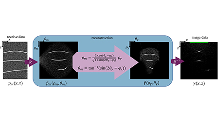 A Radon diffraction theorem for plane wave ultrasound imaging | The ...