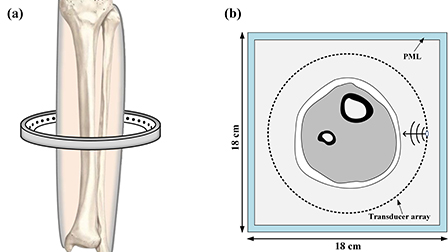 Frequency-domain full-waveform inversion-based musculoskeletal ...