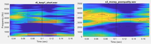 Conducting high-quality and reliable acoustic analysis: A tutorial ...