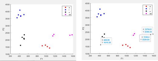 Conducting high-quality and reliable acoustic analysis: A tutorial ...