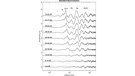 Multi-response deconvolution of auditory evoked potentials in a reduced representation space ...