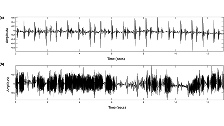 Voice reduction in cardiac auscultation sounds with reference signals ...