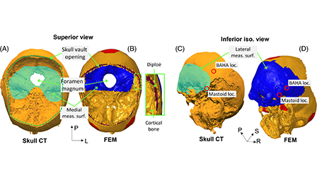 Exploration of the dynamics of otic capsule and intracochlear pressure ...