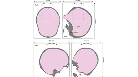 Benchmark comparison of transcranial ultrasound simulation: Comparing ...