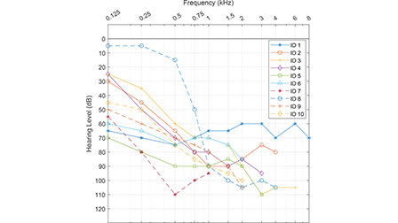 Phase coherence of cochlear microphonic potentials in cochlear implant ...