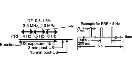 Positive chronotropic effect caused by transthoracic ultrasound in ...