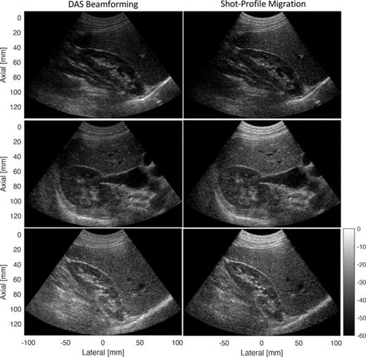 Angular spectrum method for curvilinear arrays: Theory and application ...