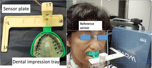 Mapping Palatal Shape To Electromagnetic Articulography Data An Approach Using 3d Scanning And