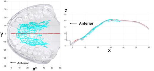 Mapping Palatal Shape To Electromagnetic Articulography Data An Approach Using 3d Scanning And