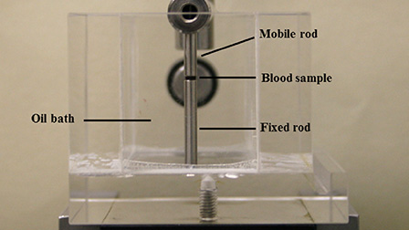 Rheological behavior of human blood in uniaxial extensional flow ...