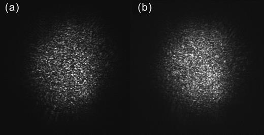 Laser performance upgrade for precise ICF experiment in SG-Ⅲ laser ...