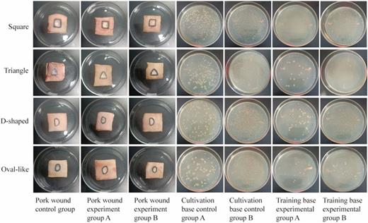 FPGA-based plasma sterilization device for wound-edge recognition ...