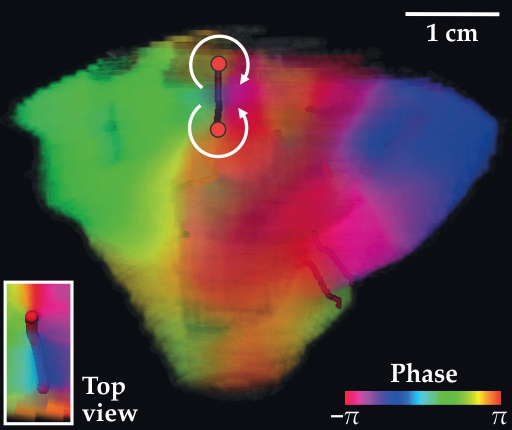 Imaging vortex filaments during cardiac fibrillation | Physics Today ...