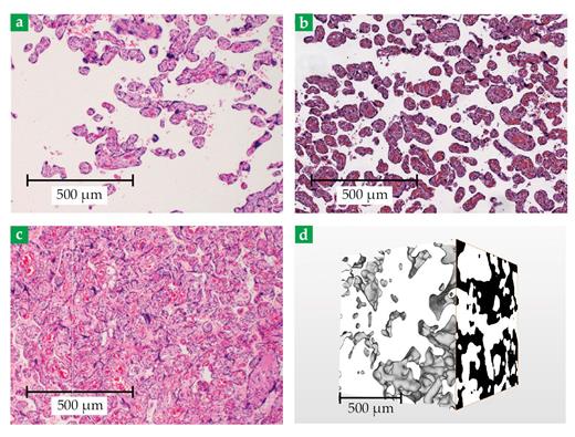 The complexities of the human placenta | Physics Today | AIP Publishing
