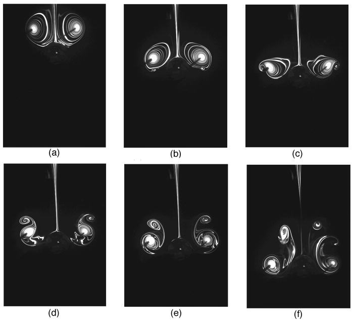 Vortex interaction with a moving sphere | Physics of Fluids | AIP Publishing
