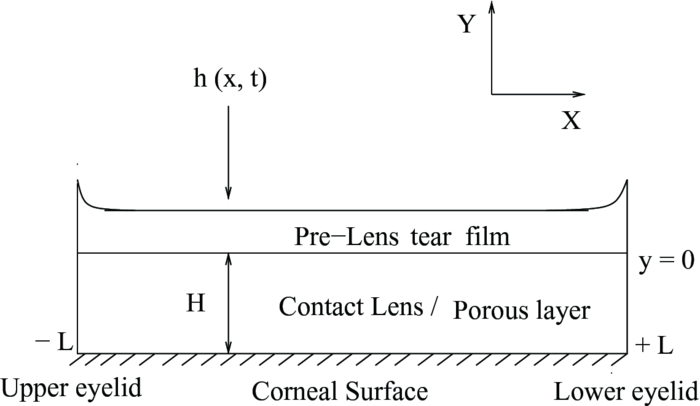 Dynamics of a pre-lens tear film after a blink: Model, evolution, and ...