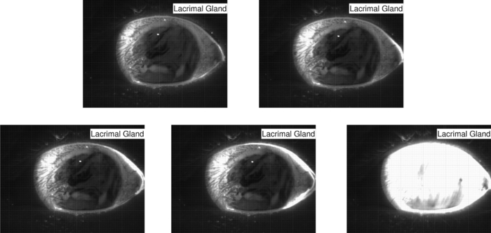 Tear film dynamics with evaporation, wetting, and time-dependent flux ...