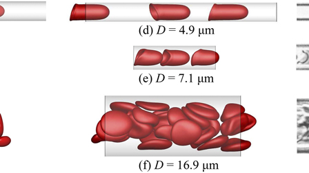 Motion, deformation, and aggregation of multiple red blood cells in ...