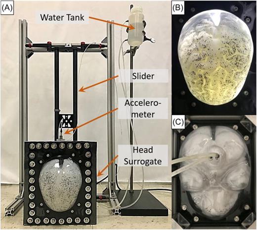 Cavitation causes brain injury | Physics of Fluids | AIP Publishing