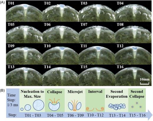 Cavitation causes brain injury | Physics of Fluids | AIP Publishing
