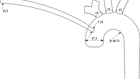 Flow patterns of blood post-application of cross-clamp during ...