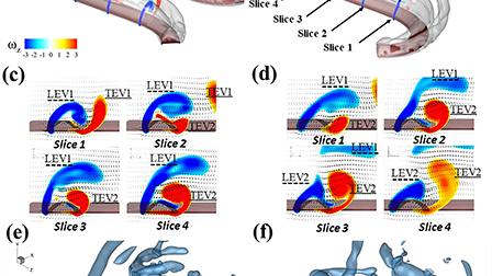 Computational analysis of vortex dynamics and aerodynamic performance ...