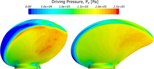 Cavitation erosion risk assessment for a marine propeller behind a Ro ...