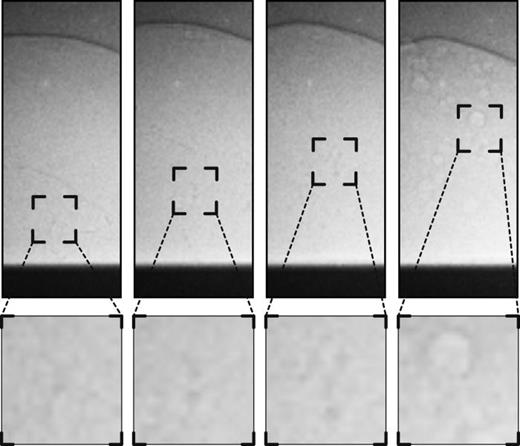 High-speed x-ray phase-contrast imaging of single cavitation bubbles near a solid boundary ...