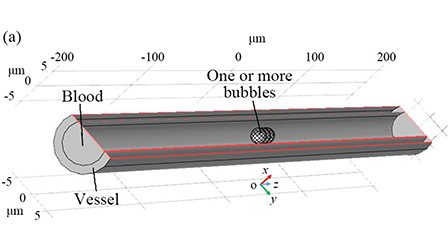 Three-dimensional numerical analysis of wall stress induced by asymmetric oscillation of ...
