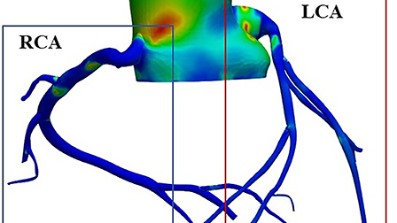 An open loop 0D-3D modeling of pulsatile hemodynamics for the diagnosis ...