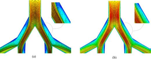 Application of heliox for optimized drug delivery through respiratory ...