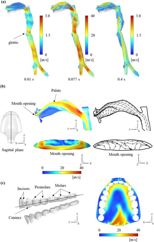 Coupled Eulerian Wall Film–Discrete Phase model for predicting ...